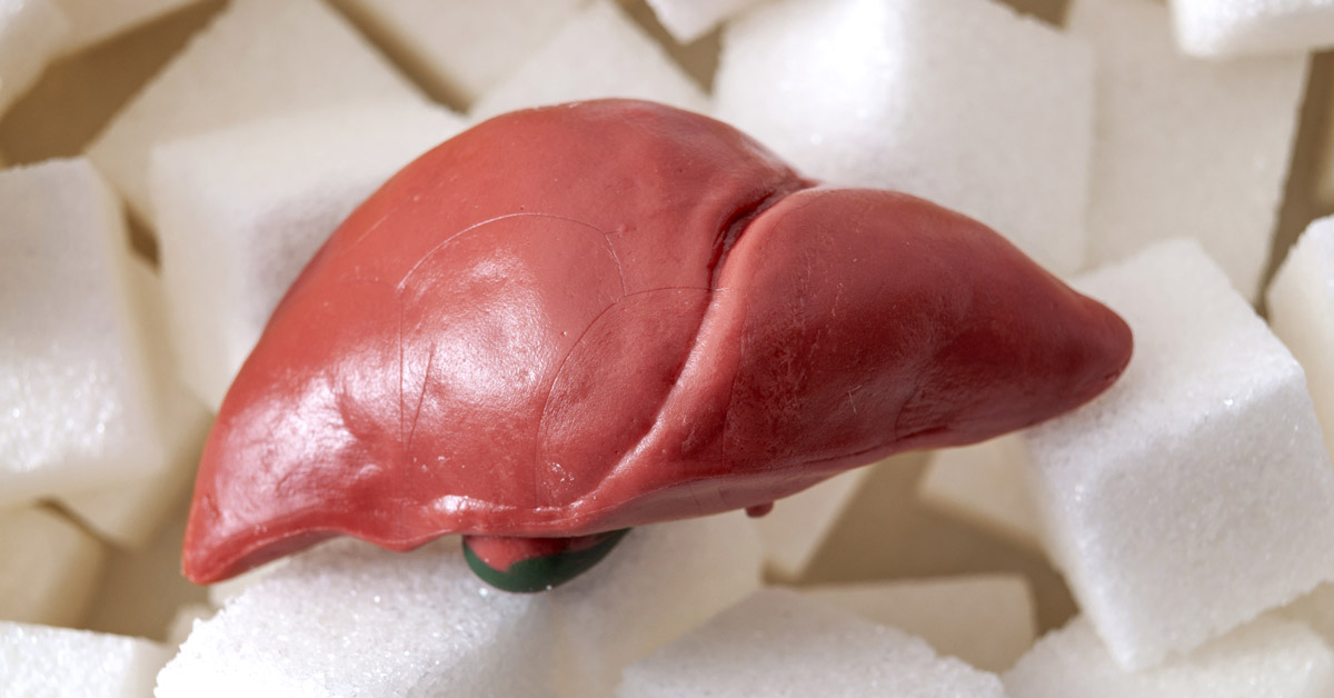 How Does Fructose Affect Fatty Liver? | Top 5 Supplements