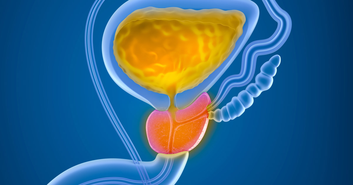 These Top 5 Prostate Supplements Can Help Reduce the Frequent Urinary ...